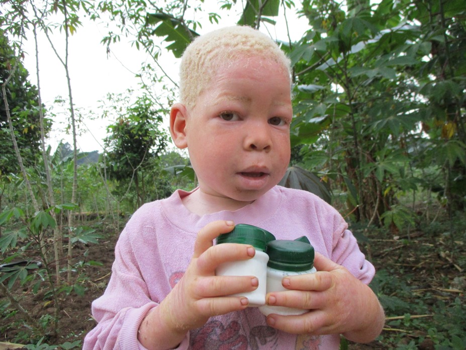 Albinism Care Package | ECM Africa